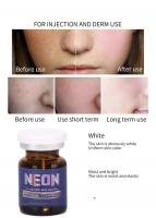 China Meso Luxury Visage Skin Serum Mesotherapy Serum Injection for Anti-Wrinkle Nourishing Skin Booster for sale