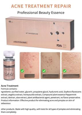 China OEM Private Label Stalidearm Meso Acne Removal Serum Vials Acne Treatment No Needle Mesotherapy Serum for sale