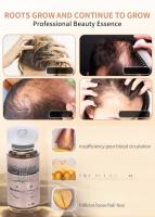 China OEM/ODM Private Label Stalidearm Repair Anti Hair Loss Hair Growth Essence for sale