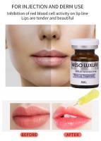 China Custom Private Label Pink Lips Treatment Hydrating Moisturizing Organic Vegan Collagen Lip Mesotherapy Serum Injection for sale