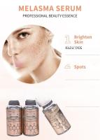 China Private Label Stalidearm Whitening Freckle Essence Remove Melasma Dark Spots Face Anti-Aging Serum for sale