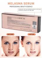 China Private Label Stalidearm Whitening Freckle Essence Remove Melasma Dark Spots Face Anti-Aging Serum for sale