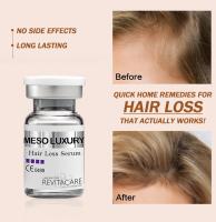 China Factory Wholesale Price Professional OEM ODM Anti Hair Loss Products Hair Growth Essence Hair Regeneration Treatment Solutions 10ml for sale