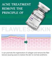 China Acne Treatment Scars Removal Acne Essence Control Shrink Pores Acne Scar Remove Facial Serum 10ml for sale