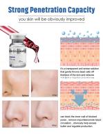 China Anti Wrinkle Professional Mesotherapy Serums  For After Microneedling Skin Whitening for sale