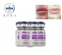 China Liporase Hyaluronidase Dissolves Hyaluronic Acid, Facial Dermal Hyaluronidase for Injection for sale