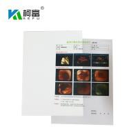 China 125 Micron White Inkjet X-Ray Film - A4, B5, 16K Sizes for Medical Imaging and Diagnostic Printing for sale