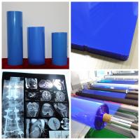 China ISO9001 Blue Medical Inkjet Printing Film 11×14 Inch for CT CR MR DR Digital Imaging with 5-Year Warranty for sale