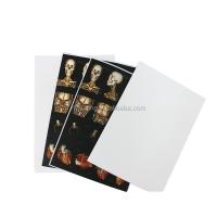 China White Base PET Inkjet X-Ray Film 150 Microns for Medical Imaging with Canon and Epson Printer Compatibility for sale