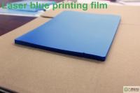 China 11x14 Inch Medical Laser X-Ray Film 195 Microns PET Material for CT DR MR Imaging for sale