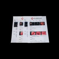China 125 Microns Semi-Transparent Laser Medical Printing Film A3 A4 A5 Sizes for HP OKI Fuji Xerox Printers for sale