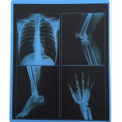 China 25cm x 30cm Blue PET Thermal Film for Medical Imaging | 100 Sheets per Pack | CT/DR/CR Compatible for sale