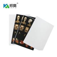 China Kefu Zhengao Inkjet X Ray Film 9600x2400dpi High Image Stability for Medical Imaging for sale