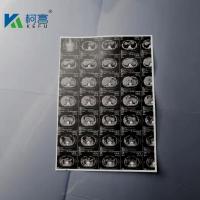 China 180 Micron A3 White Inkjet Medical X Ray Film for Canon Epson Printers for sale