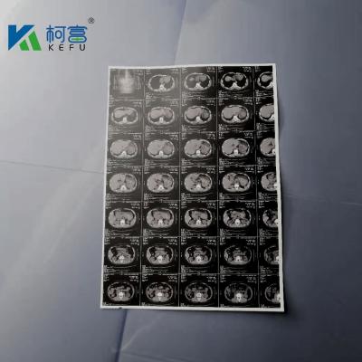 China 180 Micron A3 White Inkjet Medical X Ray Film for Canon Epson Printers for sale