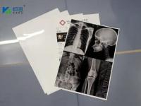 China White PET X Ray Film Sheets 13x17 Inch 180 Microns for Inkjet Printers Medical Imaging for sale