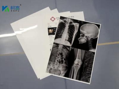 China White PET X Ray Film Sheets 13x17 Inch 180 Microns for Inkjet Printers Medical Imaging for sale