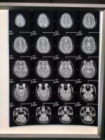 China White PET X Ray Film Sheets 13x17 Inch 180 Microns for Inkjet Printers Medical Imaging for sale