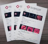 China White Glossy Inkjet X Ray Film 180 Microns 17x30m Roll for Medical Imaging for sale