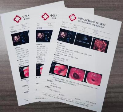 China White Glossy Inkjet X Ray Film 180 Microns 17x30m Roll for Medical Imaging for sale
