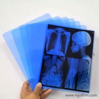 China 13x17 Inch Waterproof Laser Blue X-Ray Film 330mm x 432mm for Medical Radiology CT MR Imaging for sale
