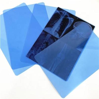 China 210 Micron 14x54m Blue X Ray Film Roll for Inkjet Medical Imaging for sale