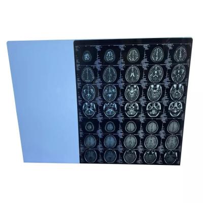 China Anti Static Medical Dry Laser Imaging Film 25cm x 35cm for Fuji Printers | 205μm Thickness for sale