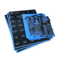China 210um Waterproof Medical Dry Film for Inkjet Printing 14x17 Inch | High Density 3.0D PET X-ray Film for sale