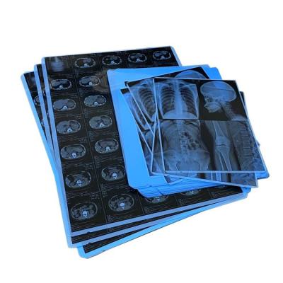 China 210um Waterproof Medical Dry Film for Inkjet Printing 14x17 Inch | High Density 3.0D PET X-ray Film for sale