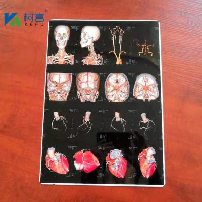 China White Inkjet X-Ray Film 150 Microns PET Base for Medical Imaging - A4/B5/16K Sizes Compatible with Canon Epson Printers for sale