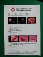 China White Inkjet X-Ray Film 150 Microns PET Base for Medical Imaging - A4/B5/16K Sizes Compatible with Canon Epson Printers for sale