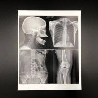 China A4 White Opaque Toner Laser X-Ray Film 125/130/150 Microns for Medical Imaging CT DR CR Systems for sale