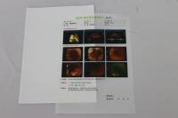 China Medical Dry Laser Film 8x10 Inch 14x17 Inch for MRI PET CT Scan Imaging - 100 Sheets per Pack for sale
