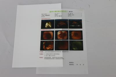 China Medical Dry Laser Film 8x10 Inch 14x17 Inch for MRI PET CT Scan Imaging - 100 Sheets per Pack for sale