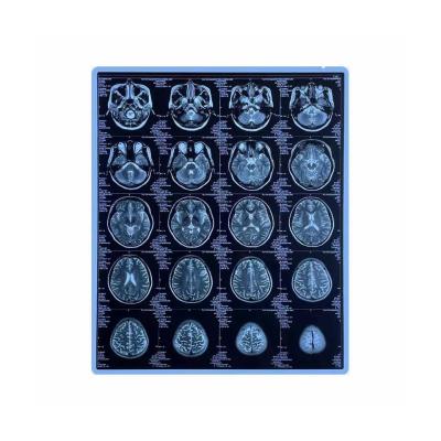 China 320dpi Resolution Medical Dry Film 10x12 Inch PET Based Thermal Printer Film for X-ray CT DR MRI Imaging for sale