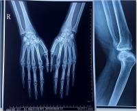 China Class I High Max Density Inkjet X-Ray Film 8x10 Inch 203mm x 254mm with 3.0D Transmission and 195μm Thickness for sale