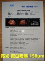 China 125 Microns White Base Opaque Inkjet Medical Film for CT Scan & Ultrasound Imaging - A4/A3 Sizes for sale