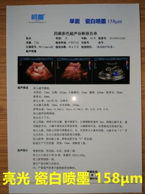 China 125 Microns White Base Opaque Inkjet Medical Film for CT Scan & Ultrasound Imaging - A4/A3 Sizes for sale