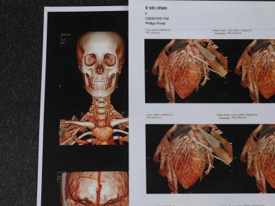 China 180μm Medical Inkjet Dry Film for Ultrasound, CT & Endoscope Imaging - A4 A3 13x17 Sizes, 125 Micron PET Base for sale