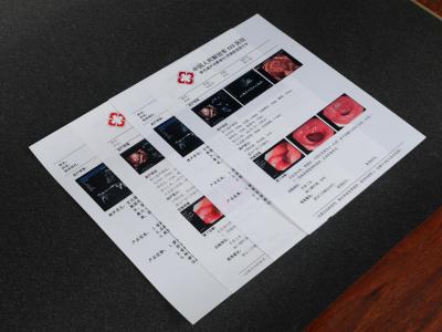 China PET Medical Dry X-Ray Film 125-180 Microns for Epson Printers - A3 A4 13x17 White Inkjet Imaging for sale