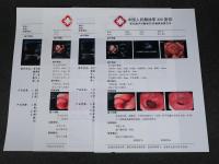 China PET Medical Dry Film 125-210 Microns for CT MRI X-ray Imaging A4 A3 13x17 Sizes for sale