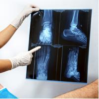 China Medical Blue X-Ray Film A4 A3 508dpi High Resolution for Radiology Graphics for sale