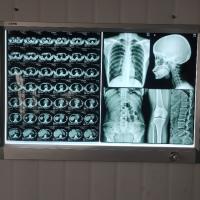 China Medical Blue X-Ray Film A4 A3 508dpi High Resolution for Radiology Graphics for sale