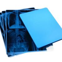 China DICOM Print 10x12 Inch X-Ray Dry Film for Medical Imaging - 210μm Thickness, 280g/㎡ Grammage for sale