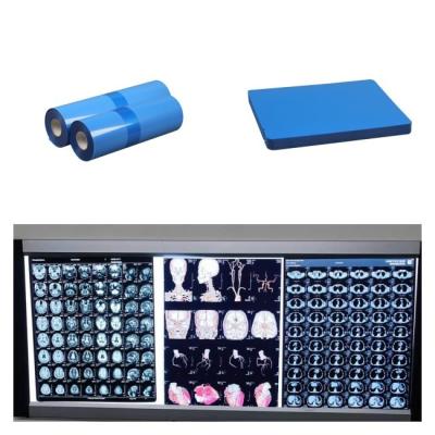 China Medical Inkjet X Ray Film 9600x2400dpi High Resolution 210 Microns Blue for sale