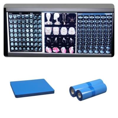 China 210 Micron Medical Inkjet X Ray Film 8x10 Inch Blue Base White Base for DR CR for sale