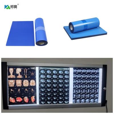 China Blue Base Inkjet Medical X Ray Film 210 Micron 8x10 14x17 A4 A3 100 Sheets for sale