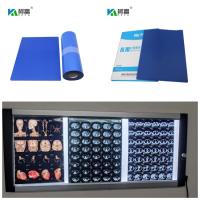 China Medical Blue Base Inkjet X Ray Film 14inch Roll 125 Sheets for DR CT MRI Dye Ink for sale