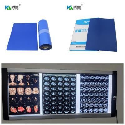 China Medical Blue Base Inkjet X Ray Film 14inch Roll 125 Sheets for DR CT MRI Dye Ink for sale