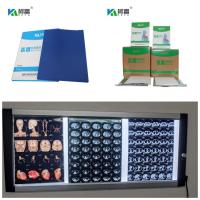 China Inkjet Medical X Ray Film 210 Microns Blue Film Thickness for High Resolution Imaging for sale